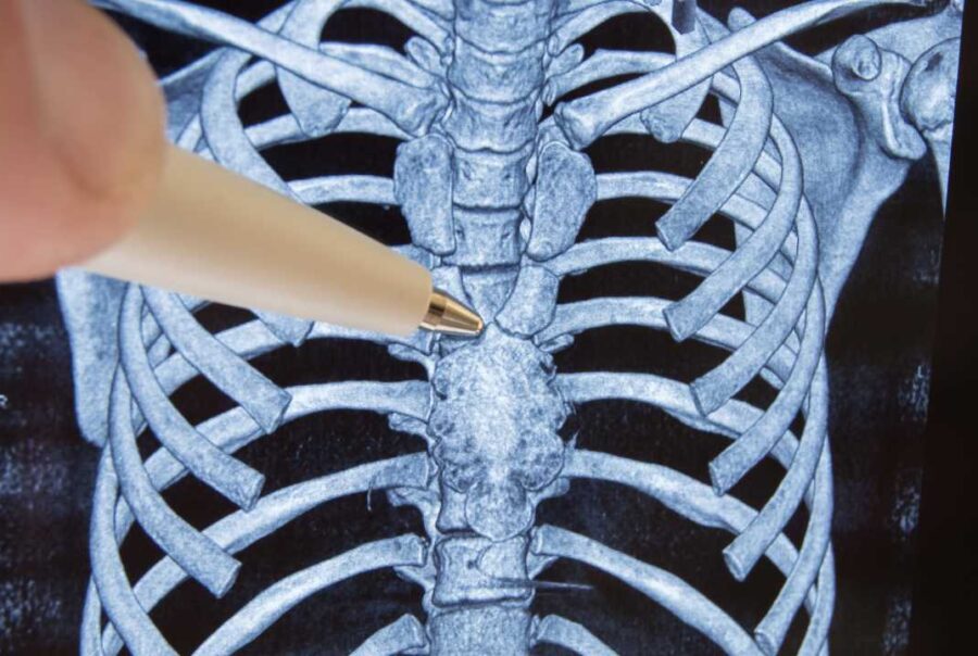 Enfermería El Corazón De La Salud Vida Y Salud