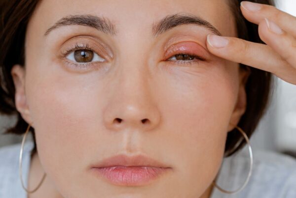 Daltonismo - Vida y Salud